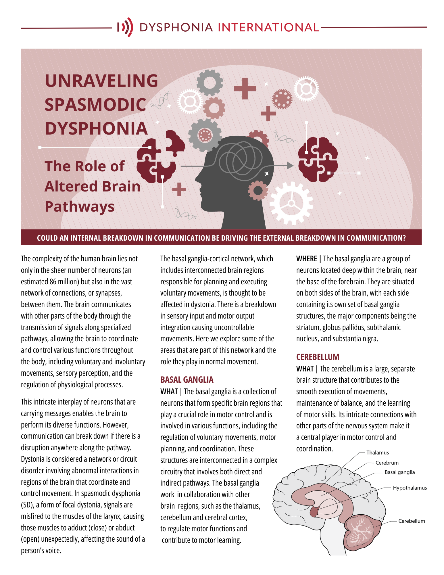 Unraveling Spasmodic Dysphonia - Dysphonia International